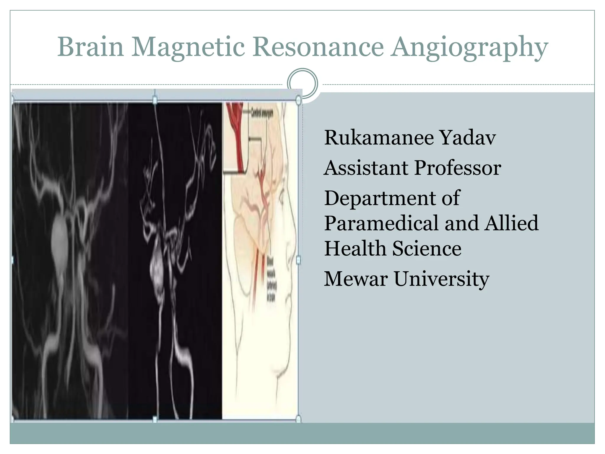 Magnetic Resonance Imaging Brain (MRA).pptx,umour, Metastases Cranial ...