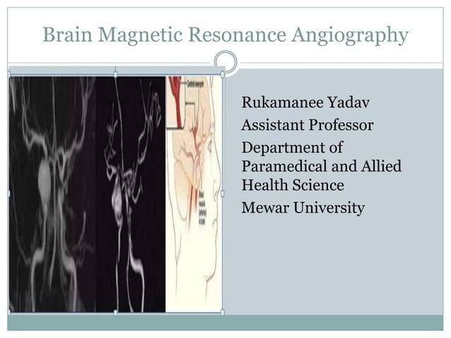 Magnetic Resonance Imaging Brain (MRA).pptx,umour, Metastases Cranial nerve lesion, Cavernous ...