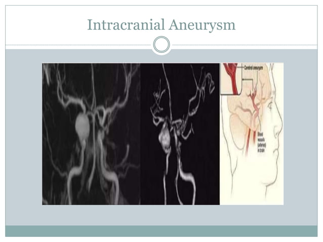 Magnetic Resonance Imaging Brain (MRA).pptx,umour, Metastases Cranial nerve lesion, Cavernous ...