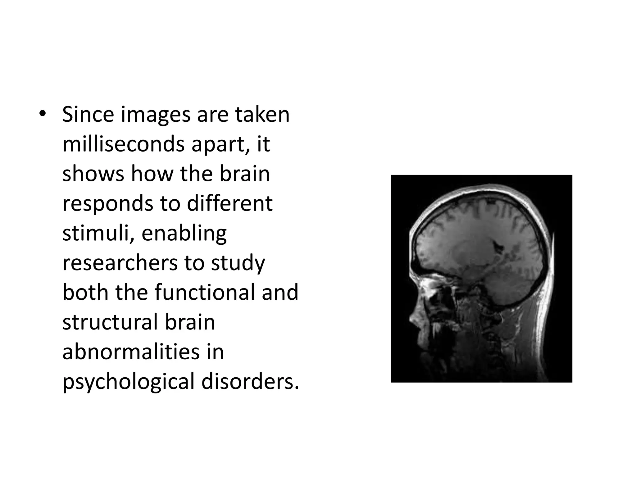 Introduction to Magnetic resonance imaging (mri) | PPTX