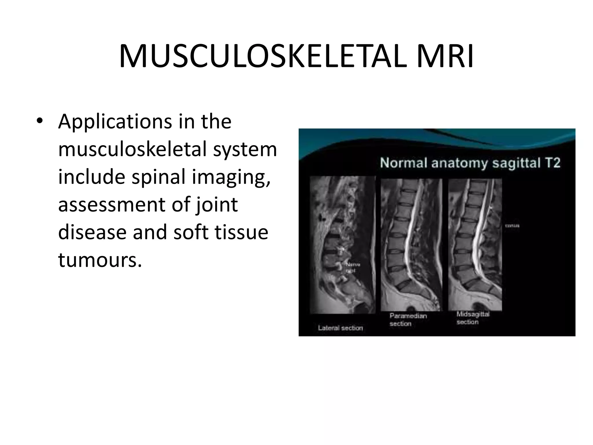 Introduction to Magnetic resonance imaging (mri) | PPTX