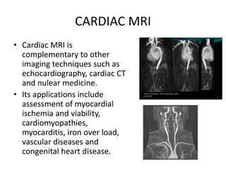 Introduction to Magnetic resonance imaging (mri) | PPTX