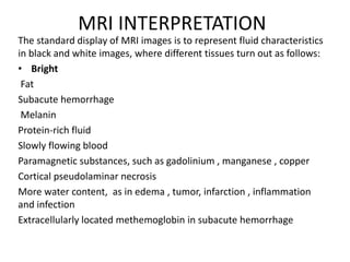 Introduction to Magnetic resonance imaging (mri) | PPTX