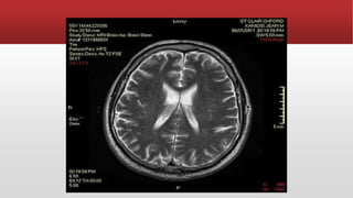 Magnetic resonance imaging (MRI) - medical information | PPTX