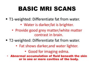 Magnetic resonance imaging (mri) by sajid | PPTX