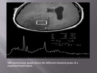 Magnetic_Resonance_(MR)_spectroscopy-1.pptx