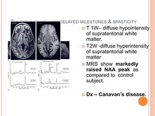 Magnetic resonance spectroscopy | PPTX