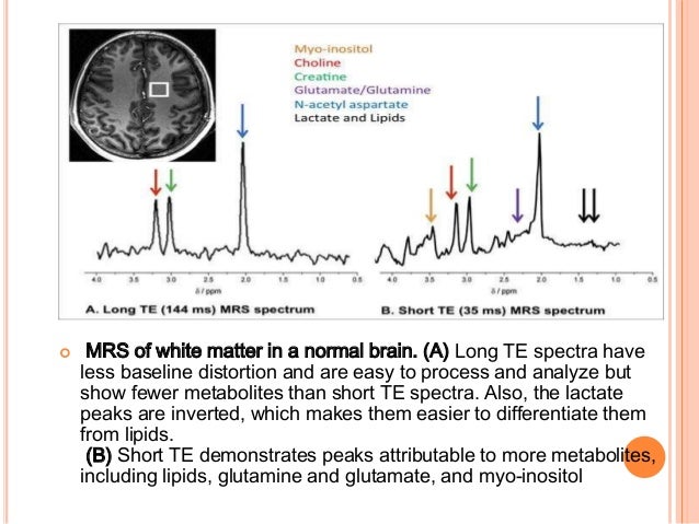 Magnetic resonance spectroscopy