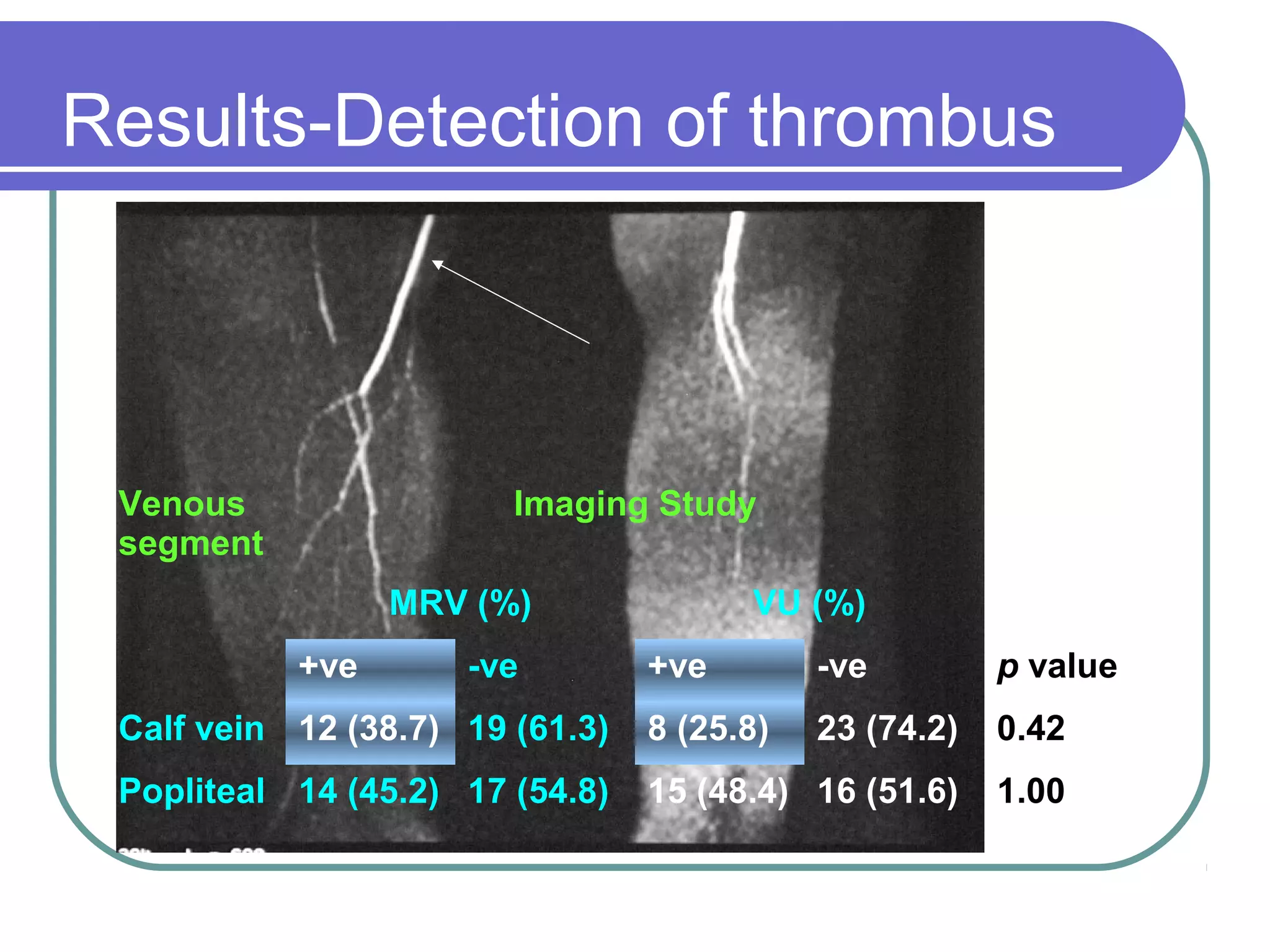 Magnetic resonance venography & venous ultrasosnography for diagnosisng ...