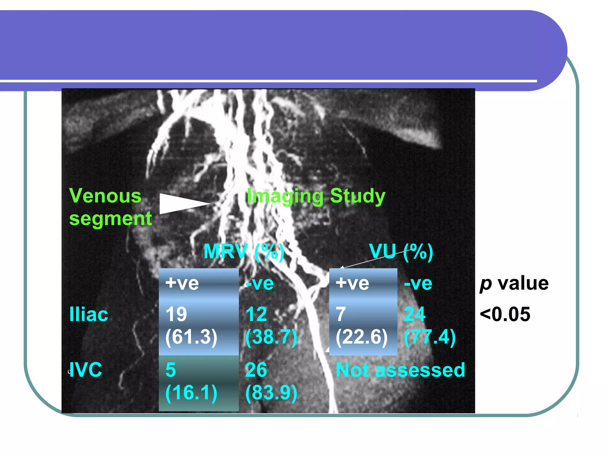 Magnetic resonance venography & venous ultrasosnography for diagnosisng ...