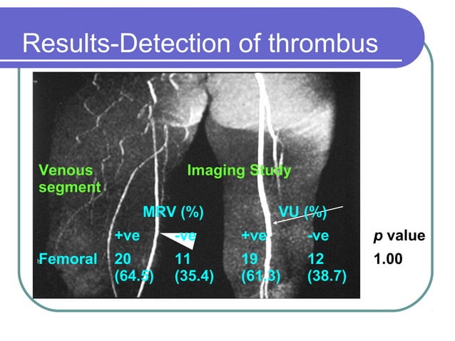 Magnetic resonance venography & venous ultrasosnography for diagnosisng ...