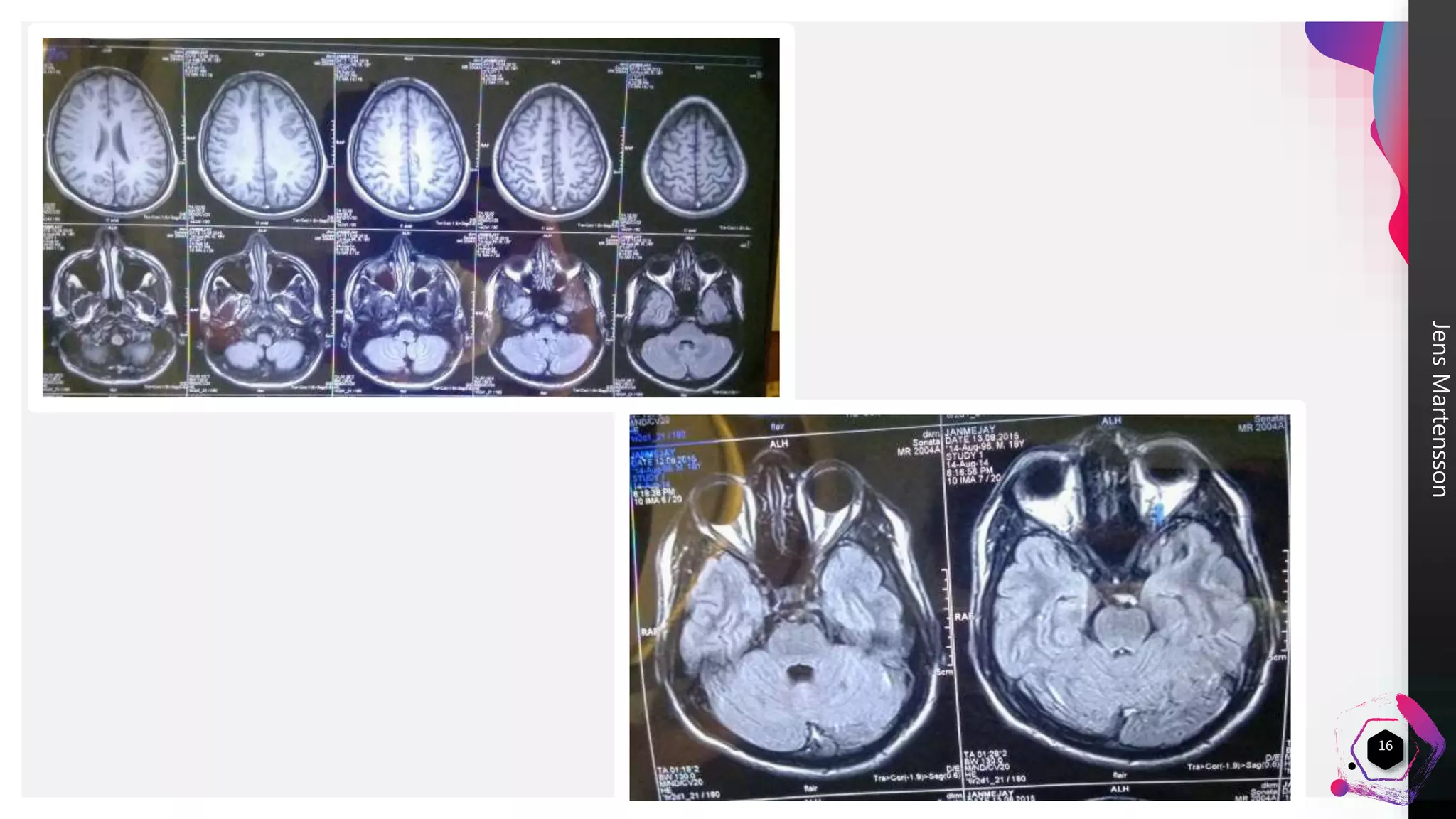 Magnetic resource imaging(mri) copy | PPT