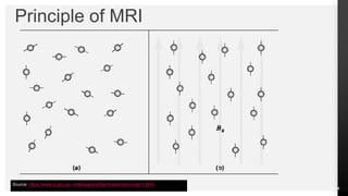 Magnetic resource imaging(mri) copy | PPT
