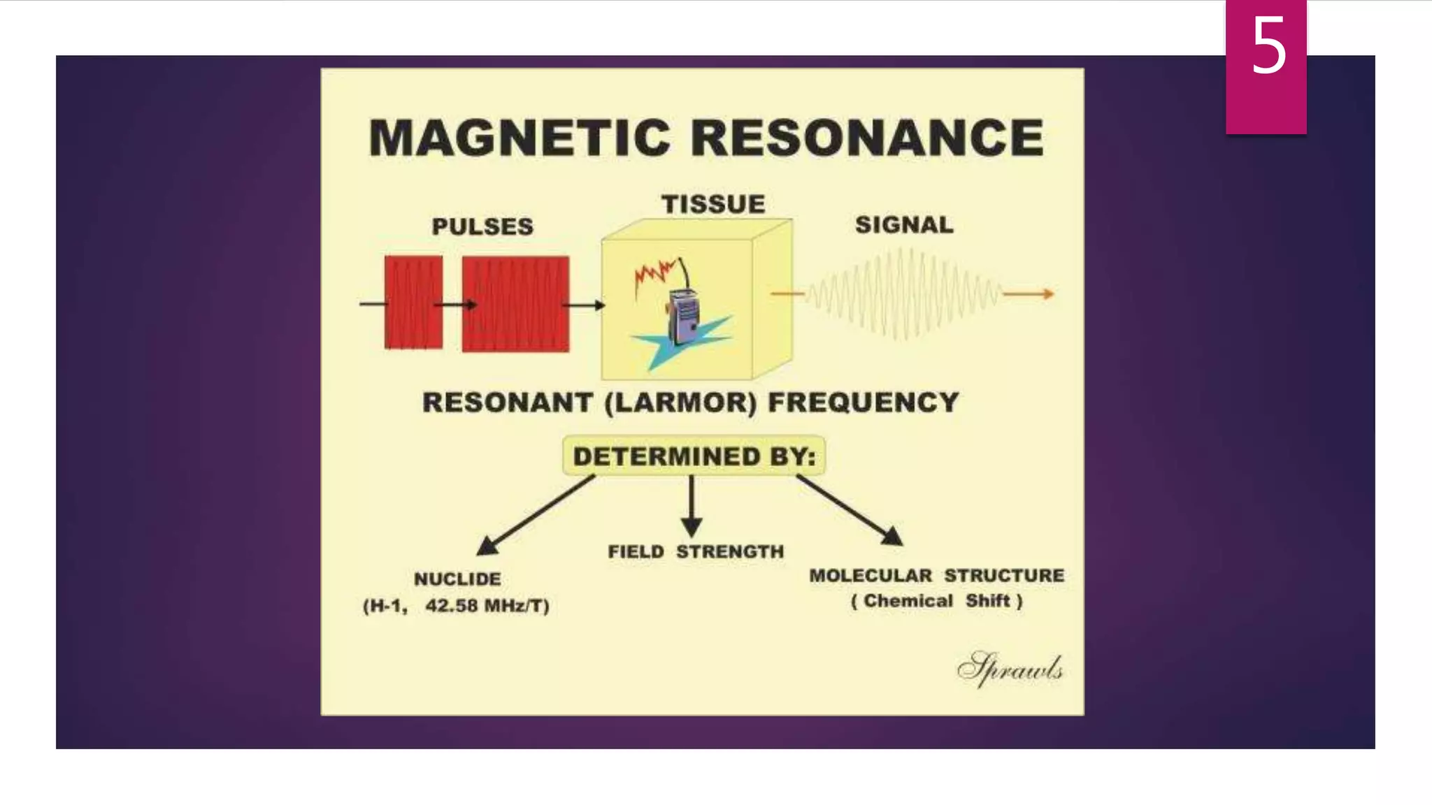 Магнетна резонанца - Magnetna rezonanca | PPTX