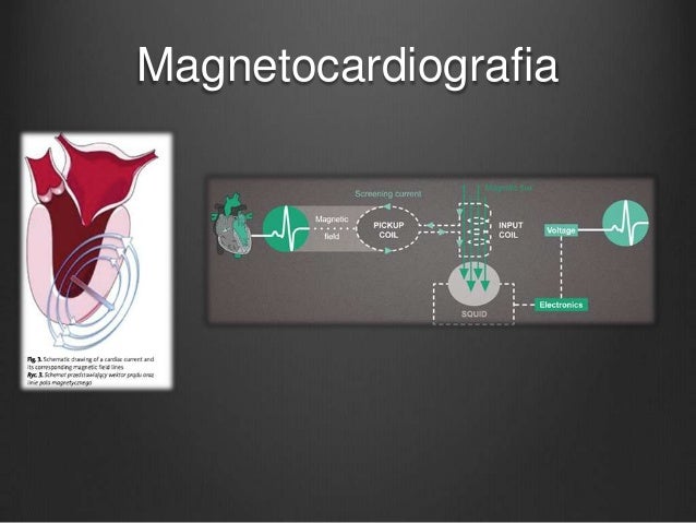 Magnetoencefalografia y magnetocardiografia