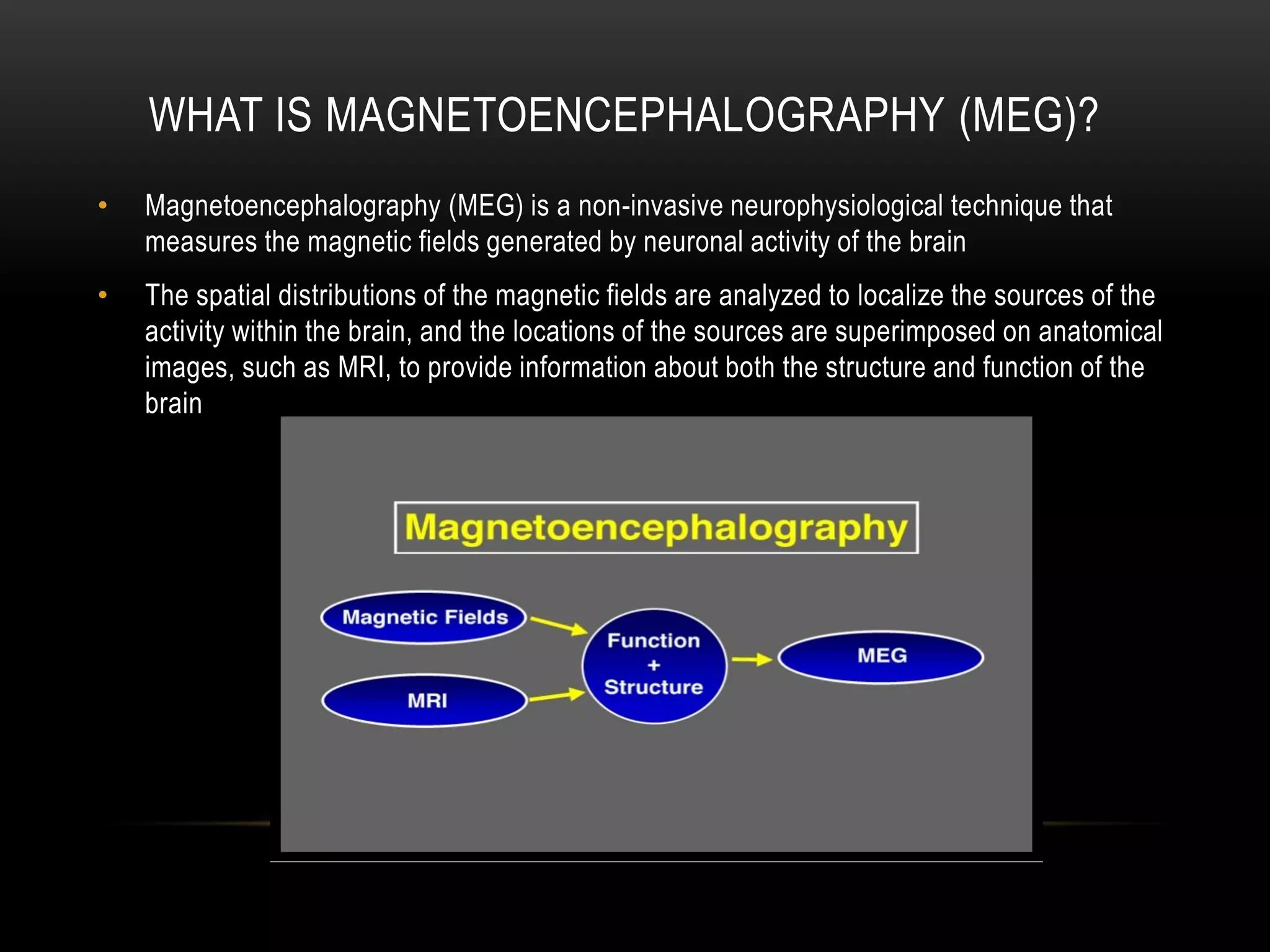 Magnetoencephalogram-MEG | PDF