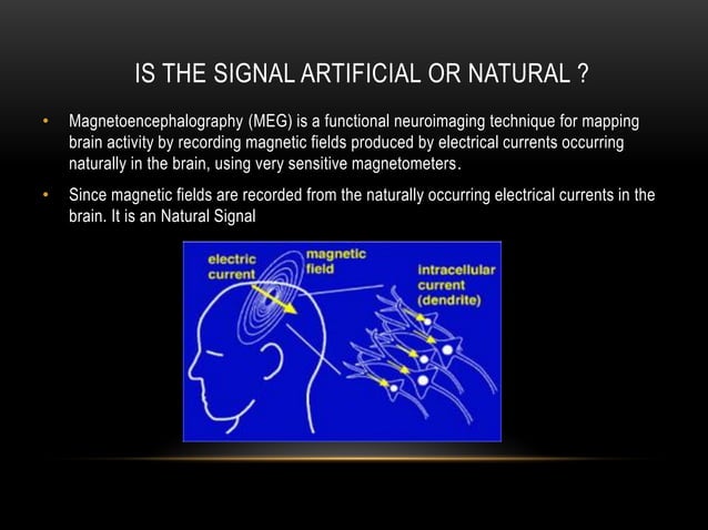 Magnetoencephalogram-MEG | PDF | Brain and Nervous System Disorders ...