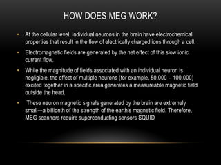 Magnetoencephalogram-MEG | PDF