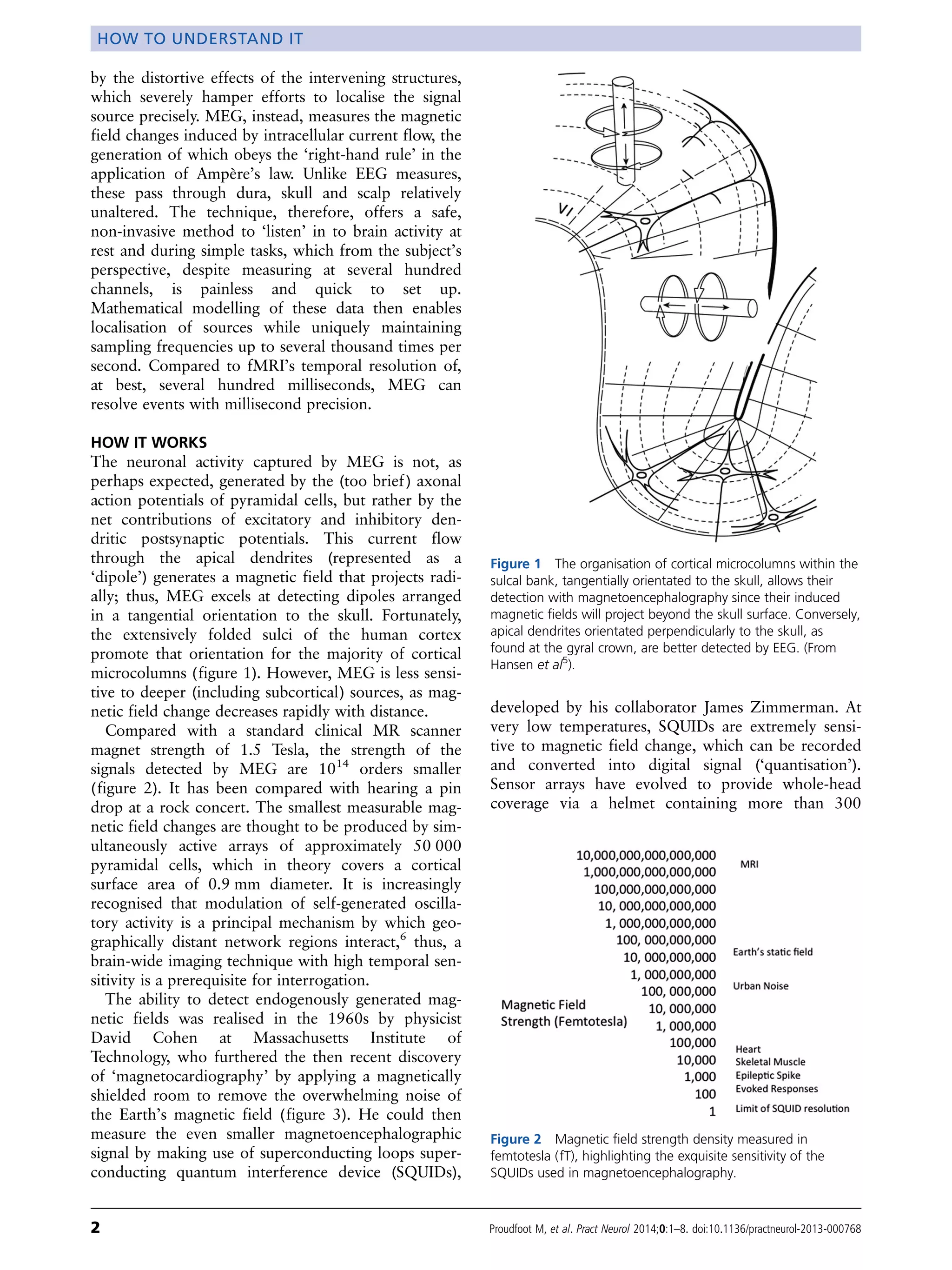 Magnetoencephalography | PDF