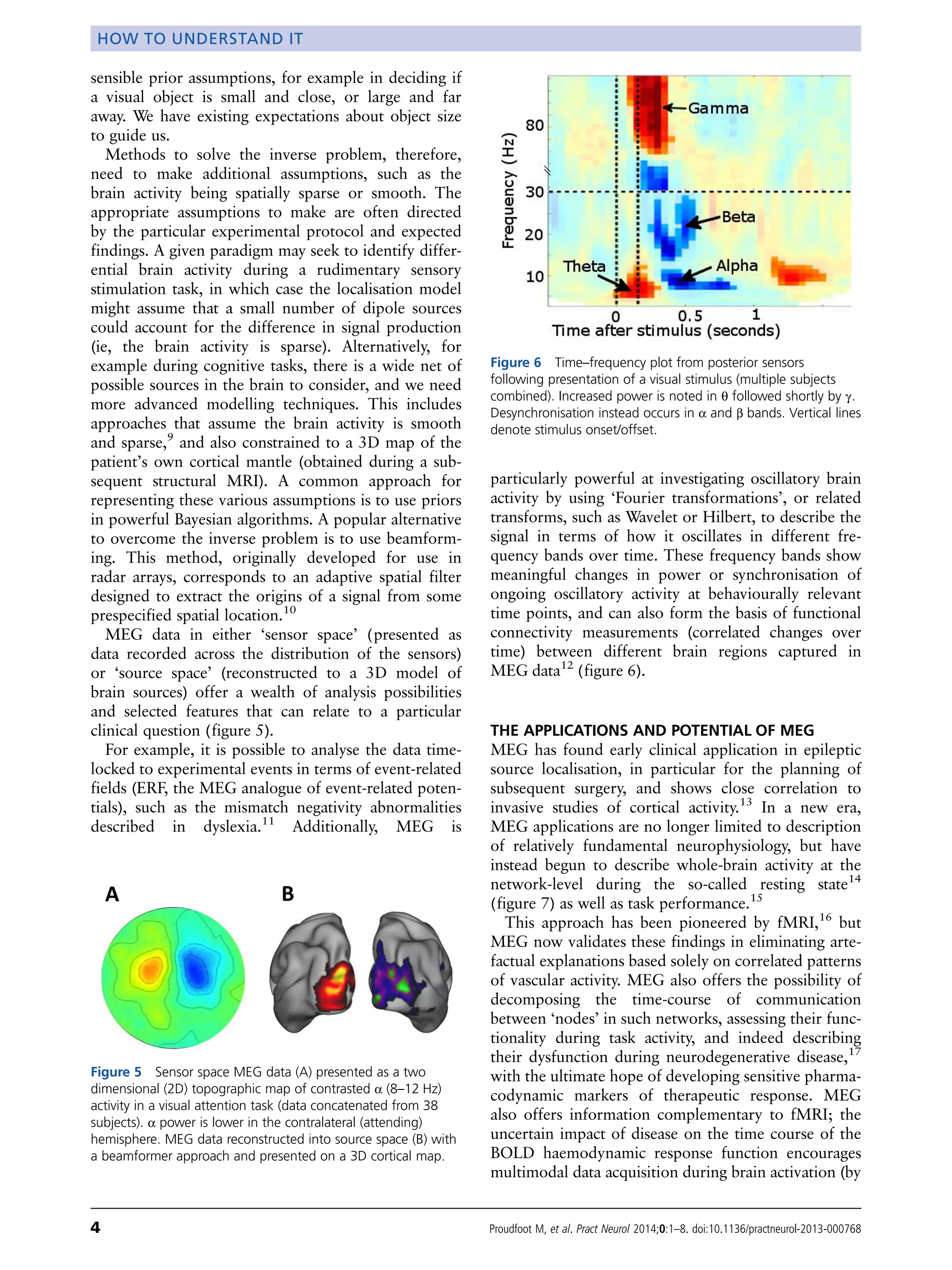 Magnetoencephalography | PDF | Brain and Nervous System Disorders | Diseases and Conditions