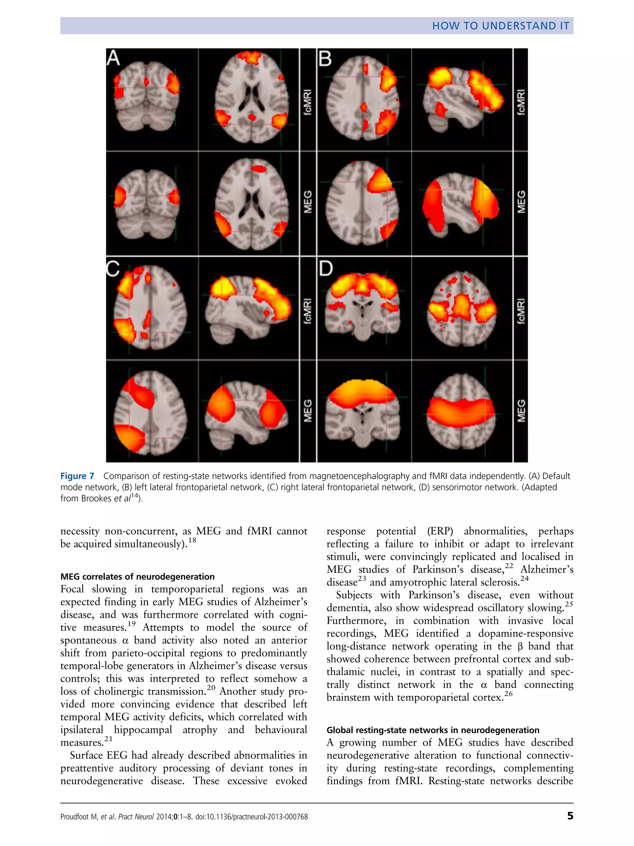 Magnetoencephalography | PDF