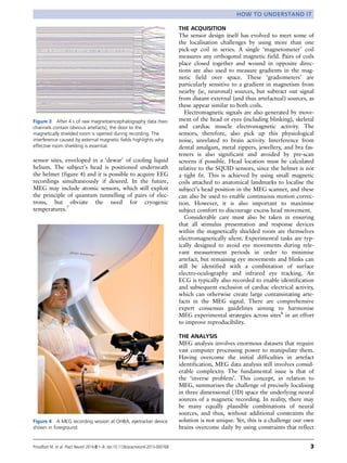 Magnetoencephalography | PDF