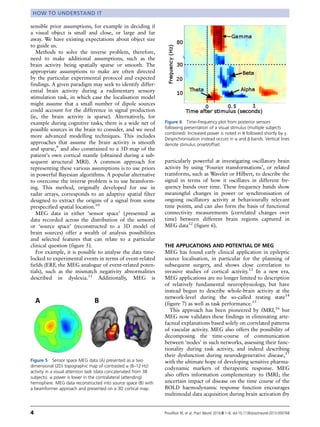 Magnetoencephalography | PDF