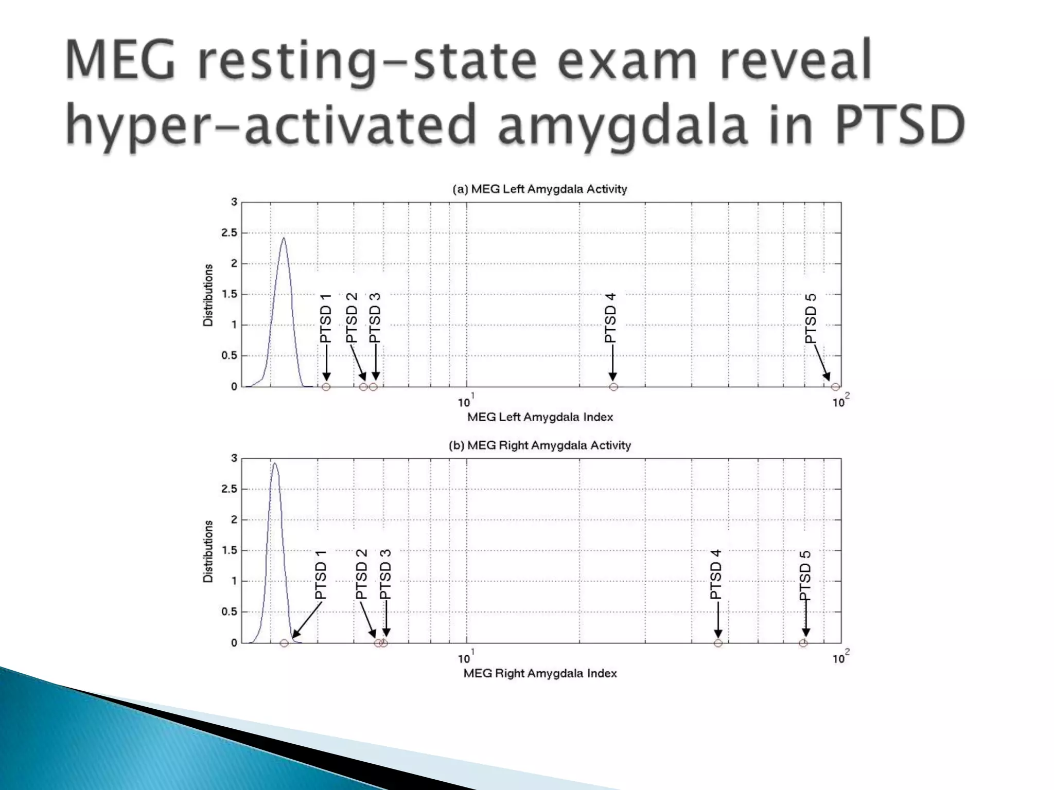 Magnetoencephalography (meg) and diffusion tensor imaging | PPTX ...