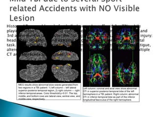 Magnetoencephalography (meg) and diffusion tensor imaging | PPTX ...