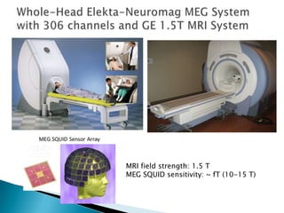 Magnetoencephalography (meg) and diffusion tensor imaging | PPTX ...