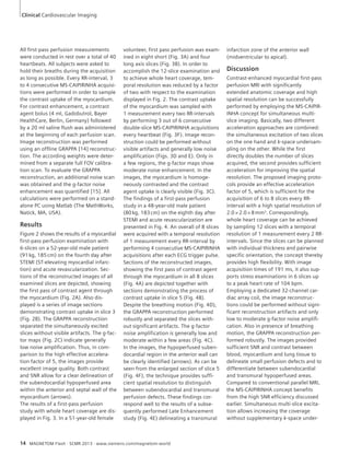 Magnetom flash 51_scmr_issue_final-00308068 | PDF