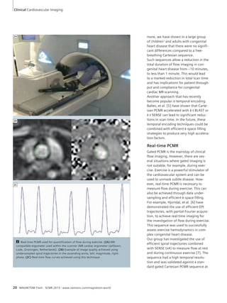 Magnetom flash 51_scmr_issue_final-00308068 | PDF | Heart and ...