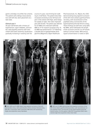 Magnetom flash 51_scmr_issue_final-00308068 | PDF