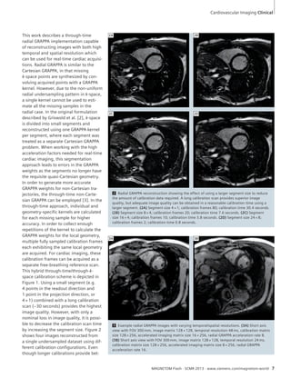Magnetom flash 51_scmr_issue_final-00308068 | PDF