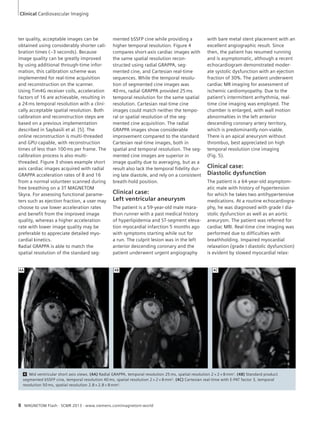 Magnetom flash 51_scmr_issue_final-00308068 | PDF | Heart and Cardiovascular Diseases | Diseases ...