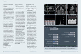 MR Angiography Edition – Issue 53 | PDF