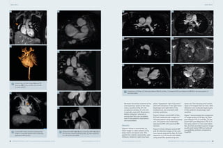 MR Angiography Edition – Issue 53 | PDF