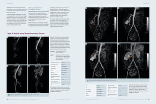 MR Angiography Edition – Issue 53 | PDF