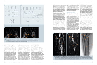 MR Angiography Edition – Issue 53 | PDF