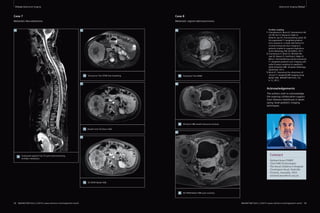 Pediatric SPR Edition – Issue 57 | PDF