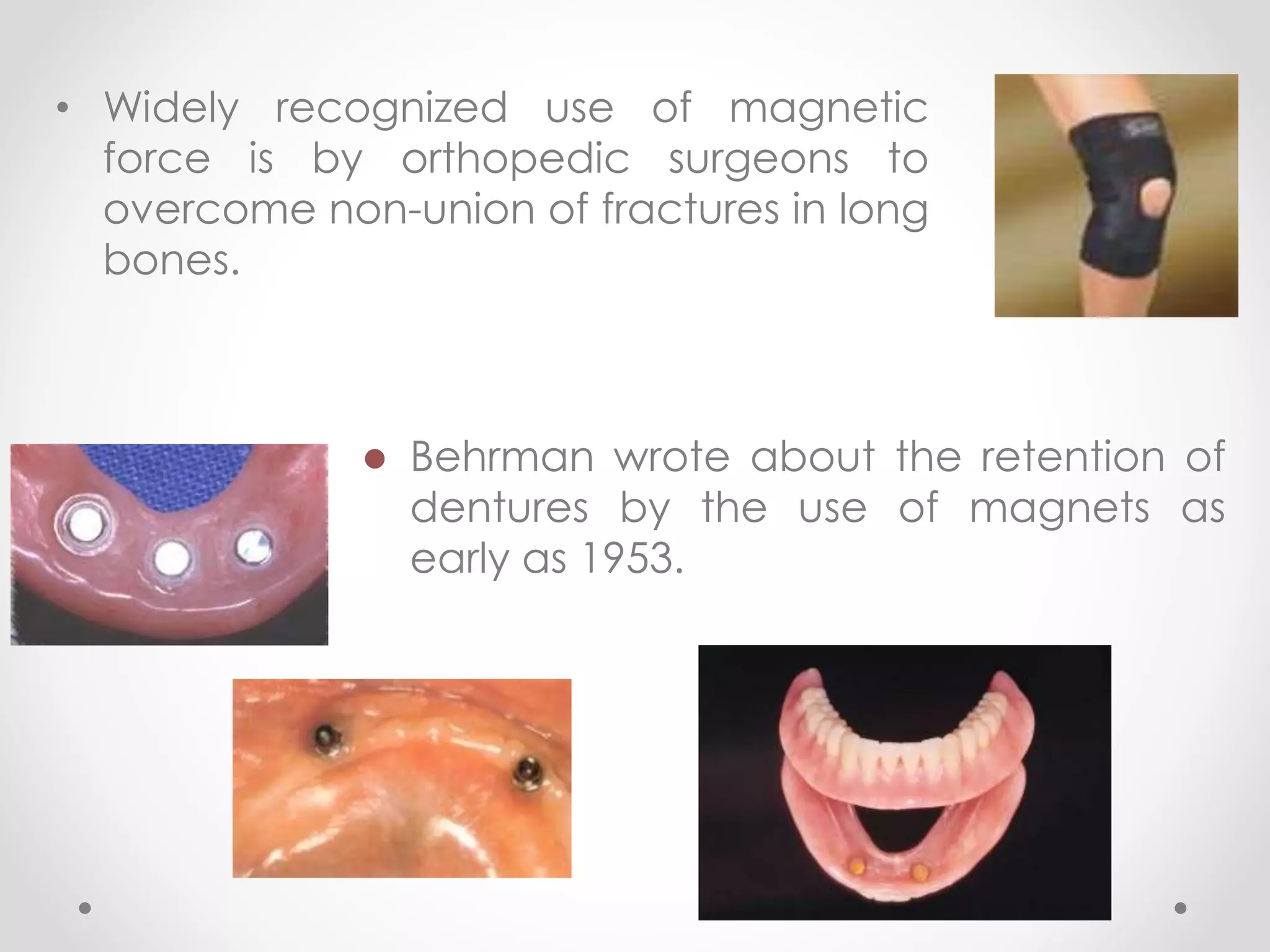 Magnets in orthodontics | PPTX