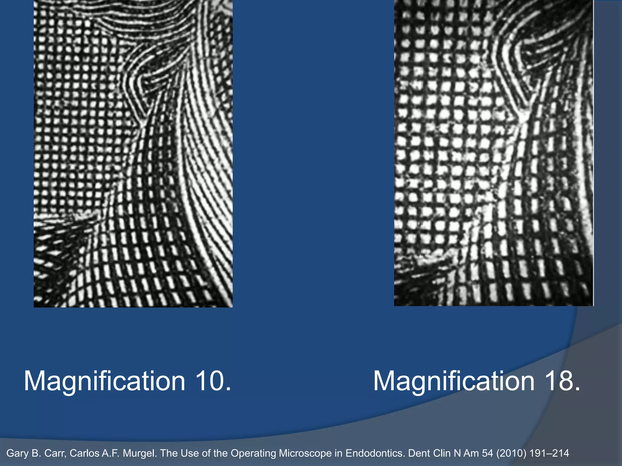 Magnification assisted dentistry | PPTX