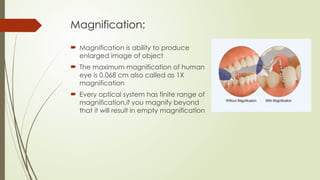 MAGNIFICATION IN CONSERVATIVE DENTISTRY AND ENDODONTICS.pptx
