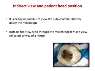 Magnification in endodontics | PPTX