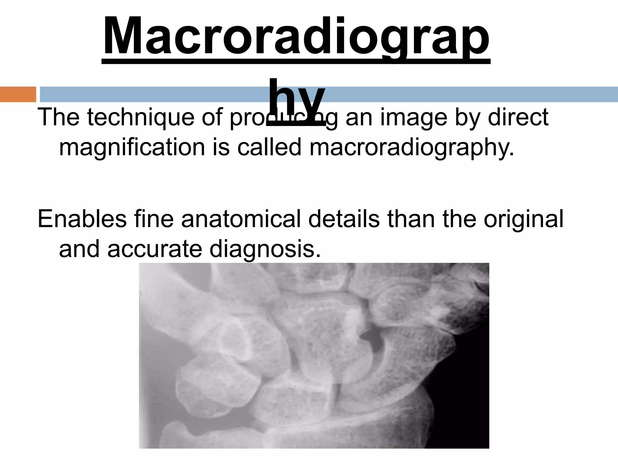 Magnification(macro and micro radiography), distortion | PPTX