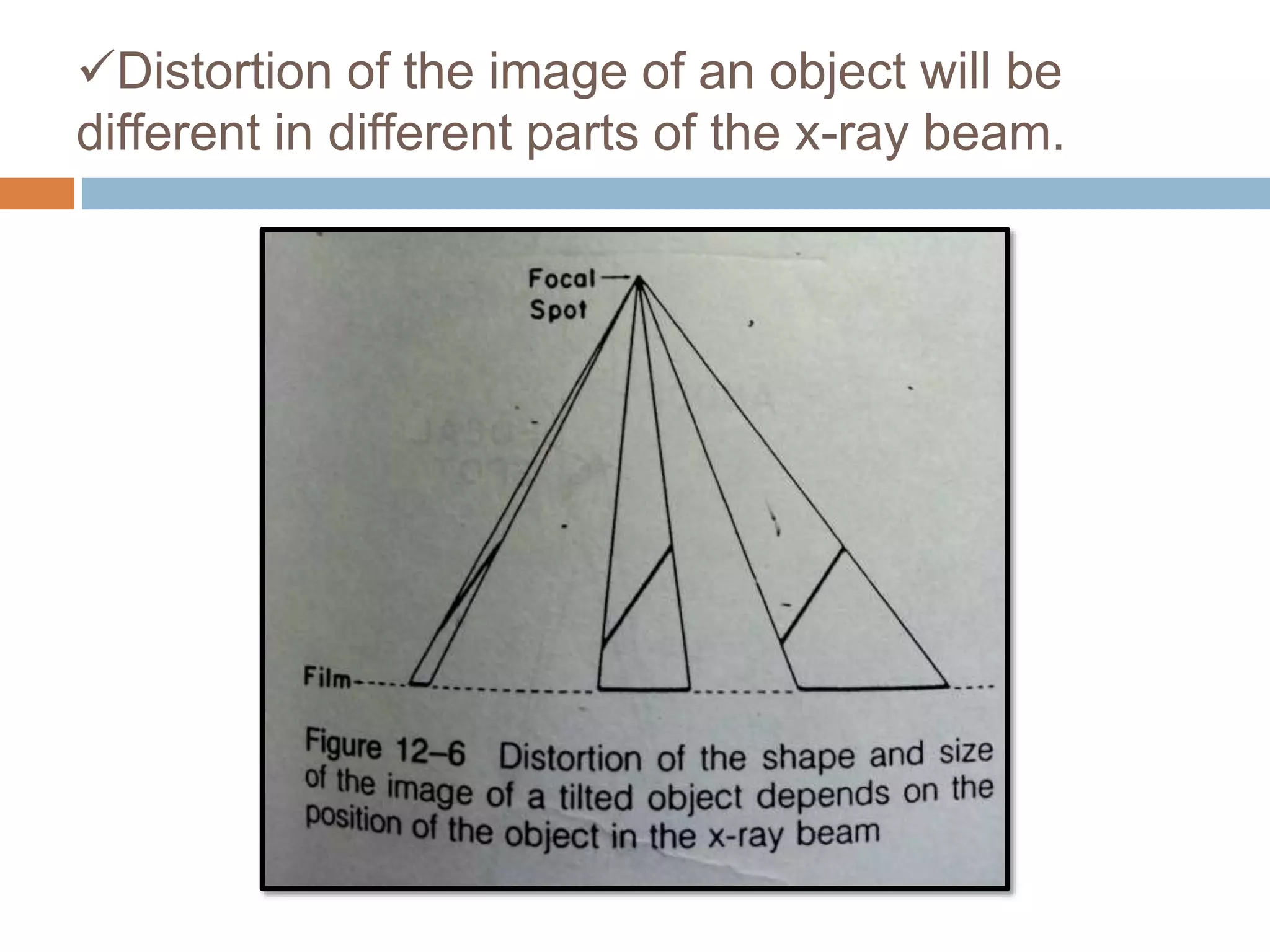 Magnification(macro and micro radiography), distortion | PPTX