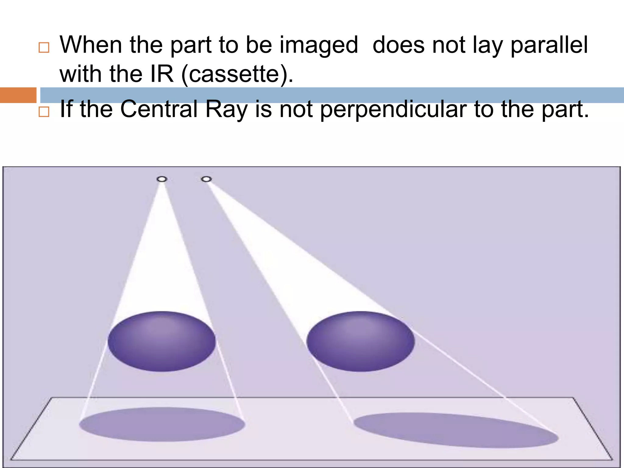 Magnification(macro and micro radiography), distortion | PPTX