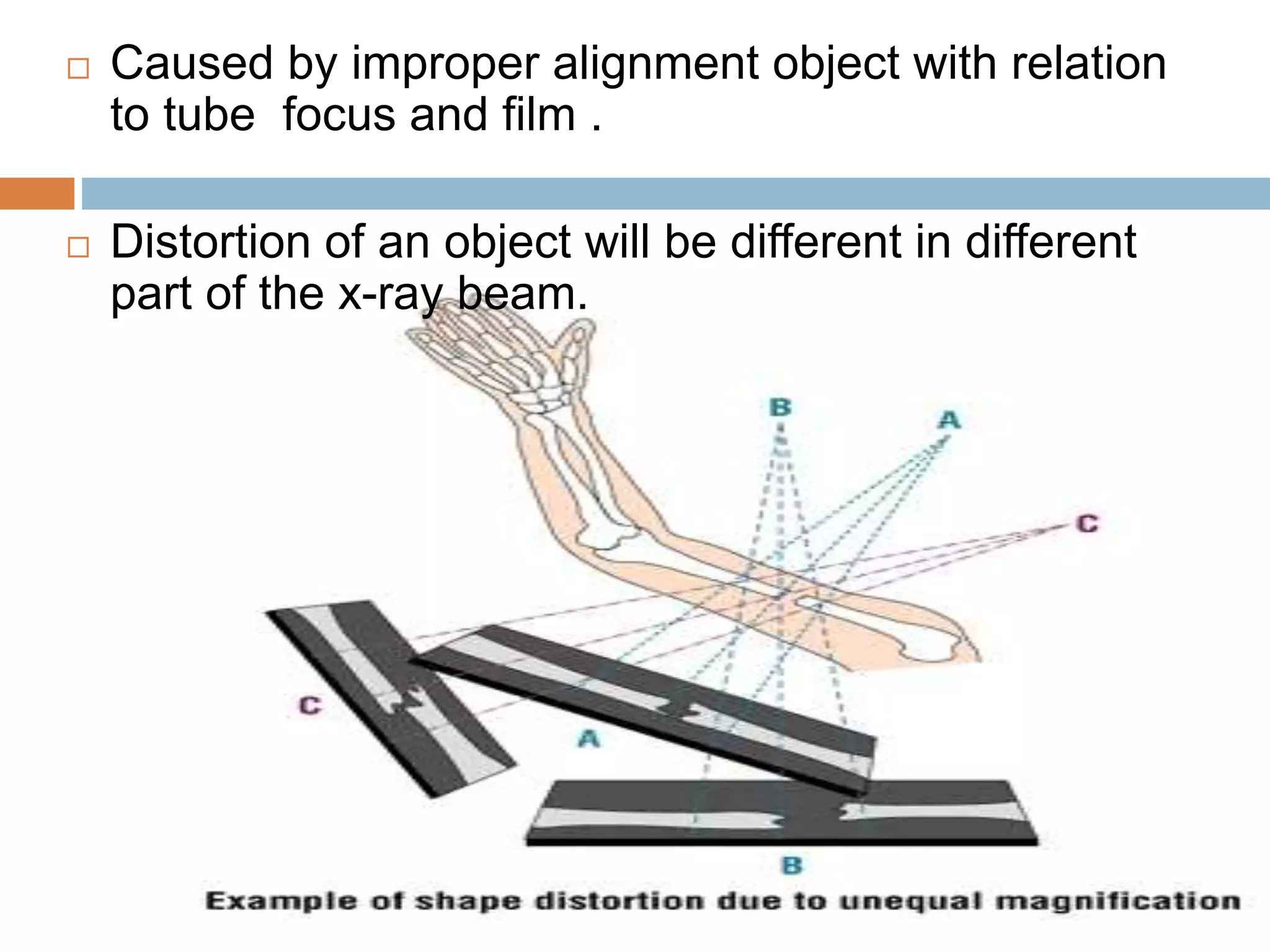 Magnification(macro and micro radiography), distortion | PPTX