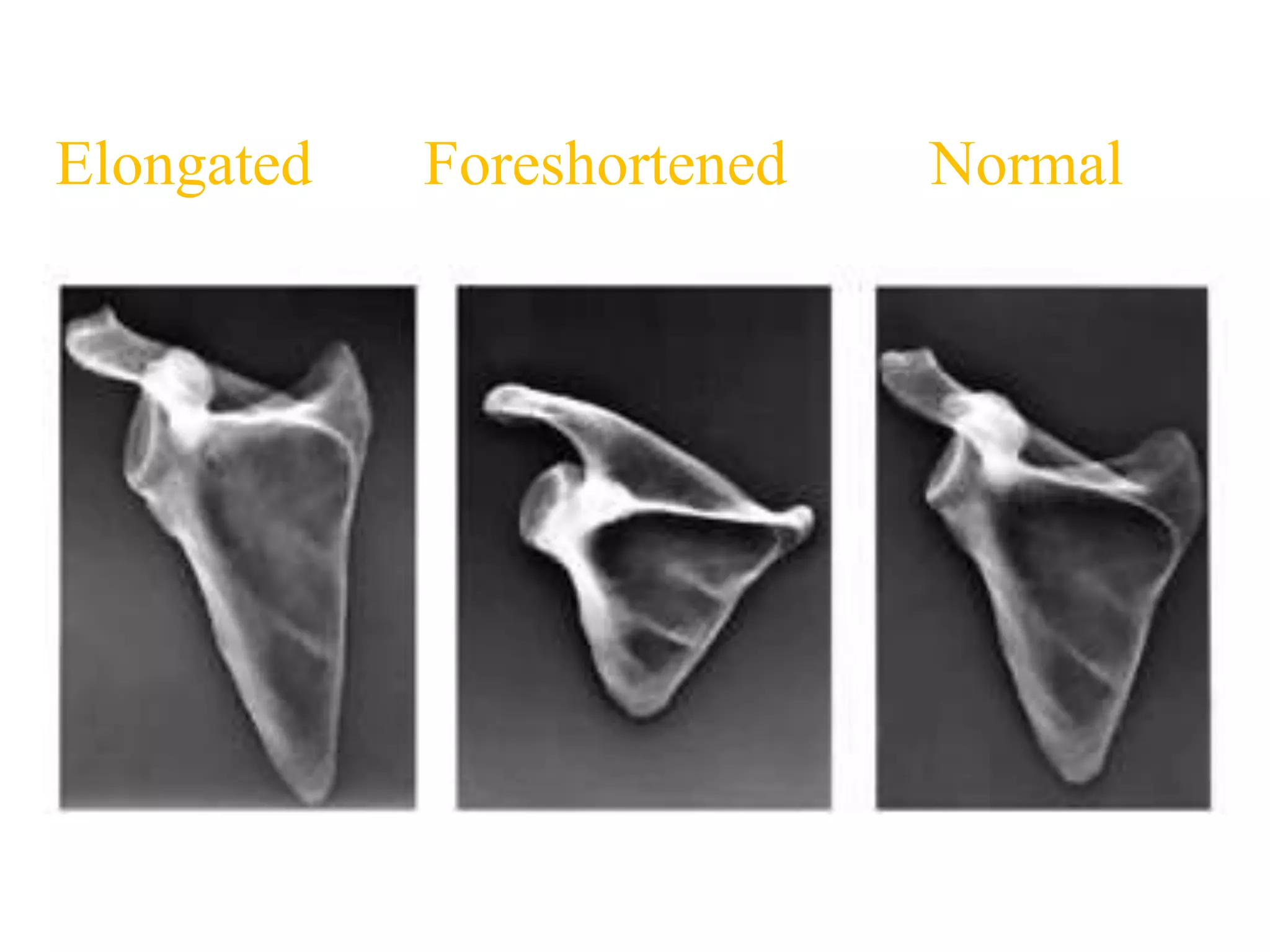 Magnification(macro and micro radiography), distortion | PPTX