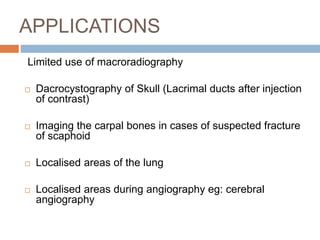 Magnification(macro and micro radiography), distortion | PPTX